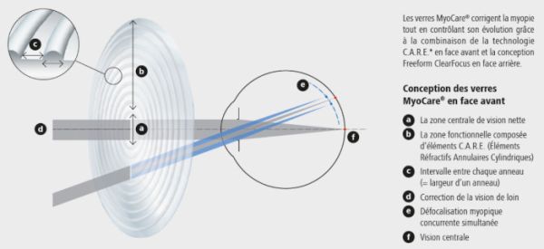 Zeiss MyoCare : des verres de contrôle myopique adaptés à l’âge
